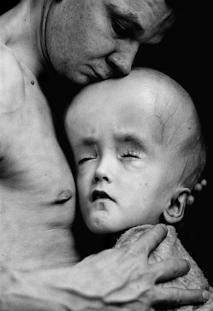 Chernobyl Heart: The Future For Japan’s Children…